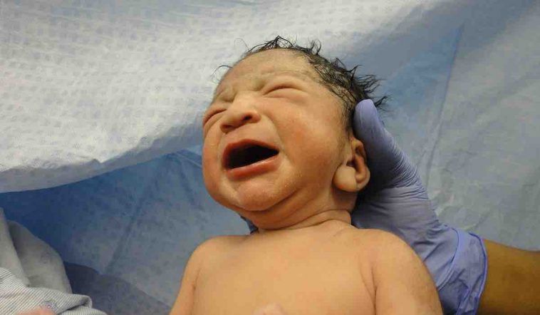 Un bébé brésilien est né avec une "vraie" queue humaine de 12 ...
